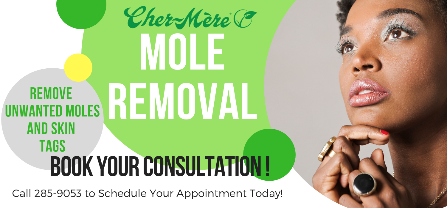 Mole Removal – Cher-Mere