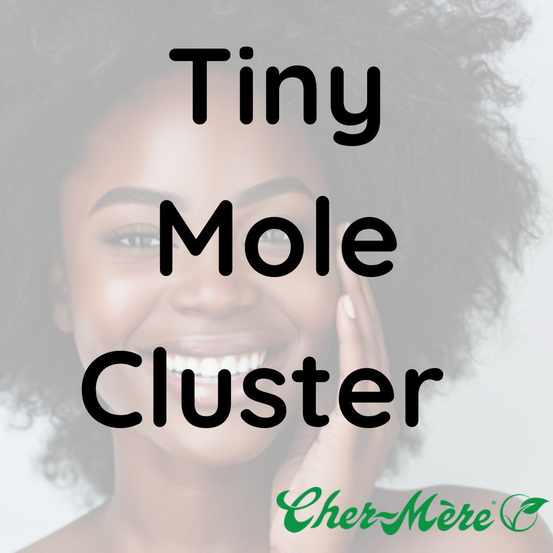 Tiny Mole Cluster – Cher-Mere