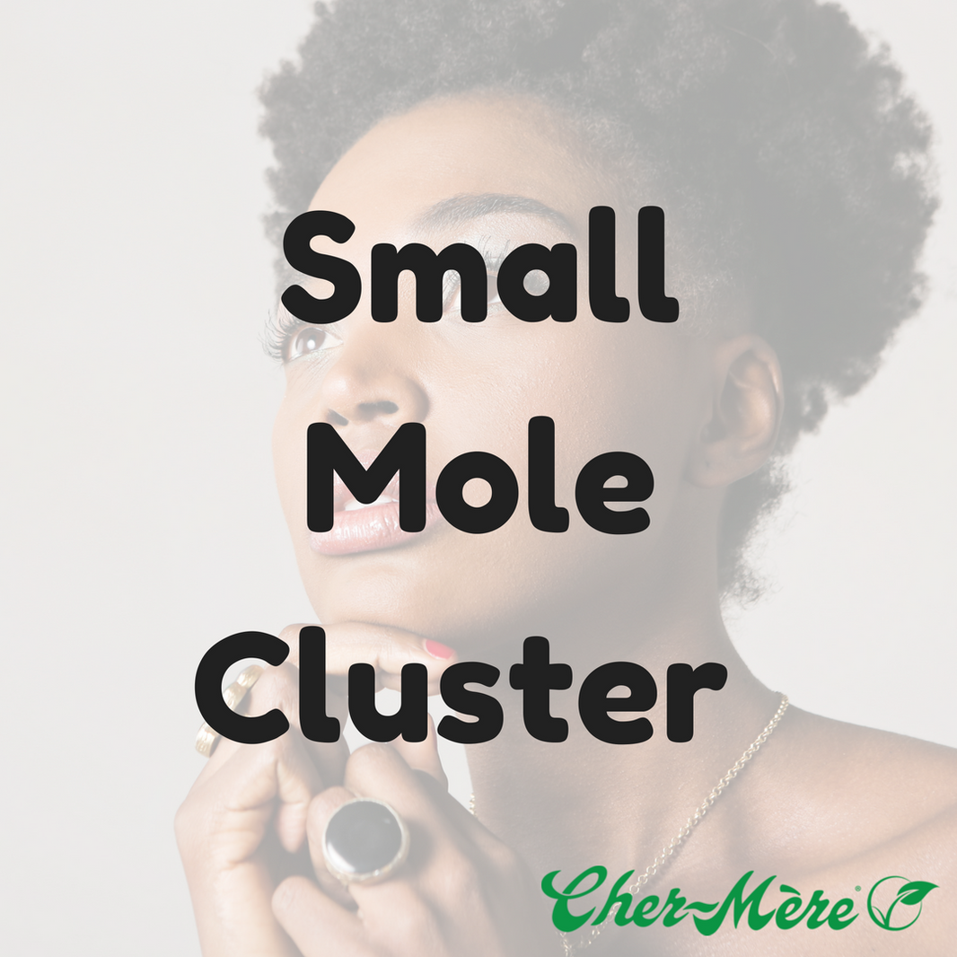 Mole Removal – Cher-Mere